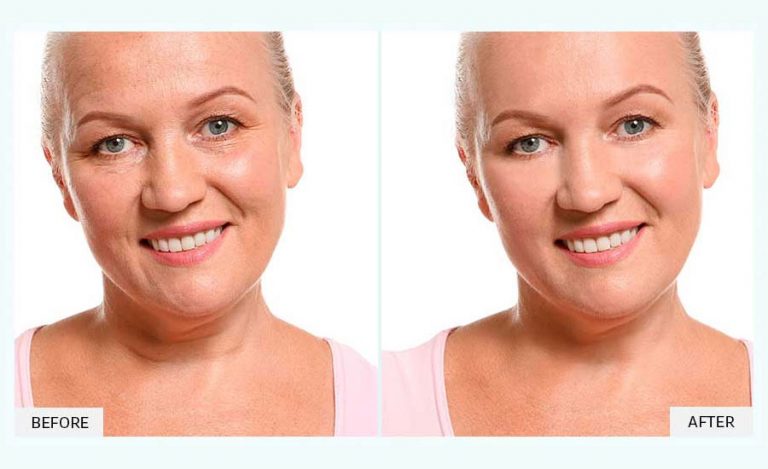 Lift Factor Plus Reviews (2021) - Advanced Skincare Wrinkle Eraser